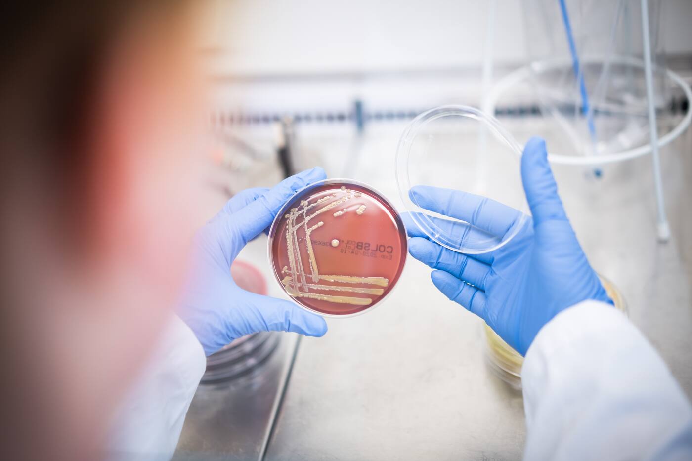 How to prevent a Listeria outbreak